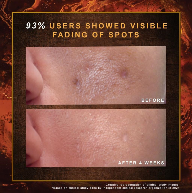 Indulekha Ayurvedic Soap 100g (Pack of 3)